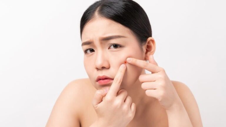 Stages and Factors Influencing the Progression of Scar Healing in ...